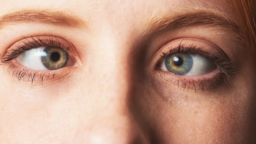 Schielen – Ursachen und Behandlung - FITBOOK