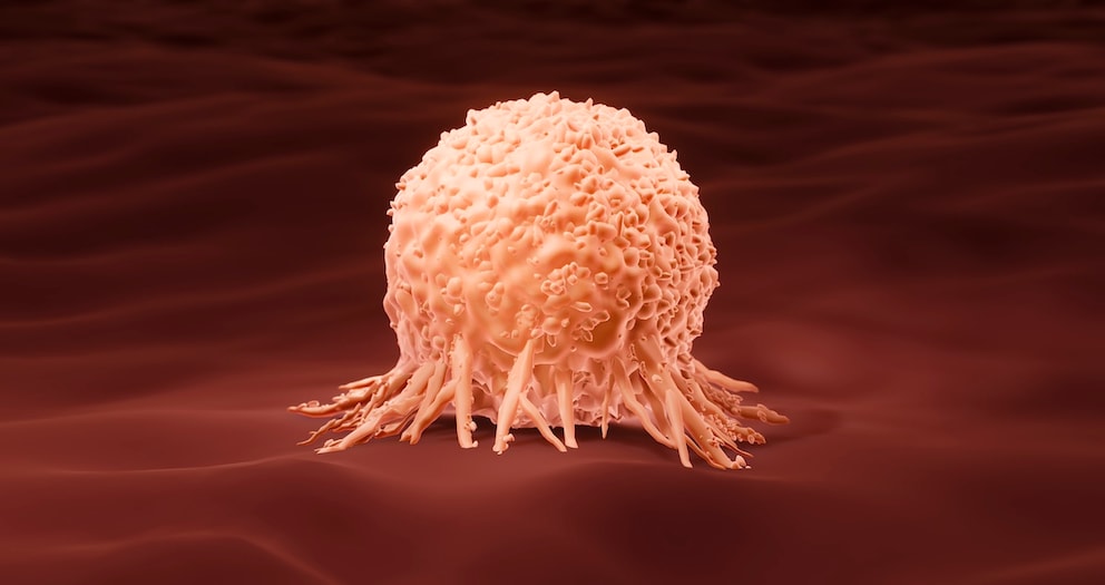 Unerwarteter Faktor erhöht das Blasenkrebs-Sterberisiko- FITBOOK